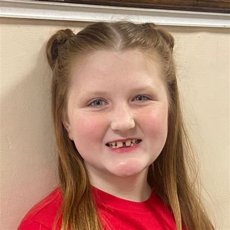 Tspearrelated Ectodermal Dysplasia Nfed