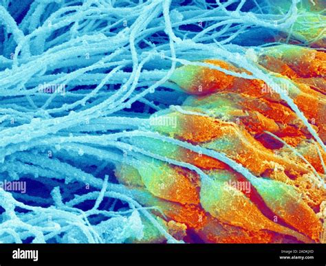 Sperm Production Coloured Scanning Electron Micrograph Sem Of Sperm Cells Spermatozoa In