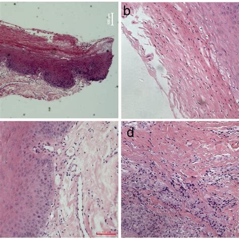 Hematoxylin Eosin Staining For Histopathology A Squamous Epithelial Download Scientific