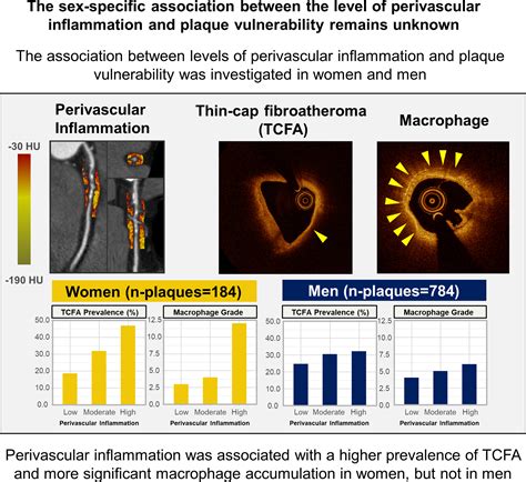 sex specific association between perivascular inflammation and plaque
