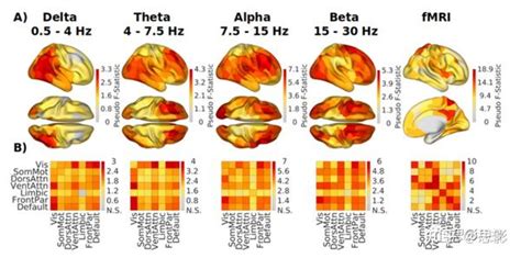 脑电图的功能连通性具有被试特异性，与表型相关，与fmri不同 知乎