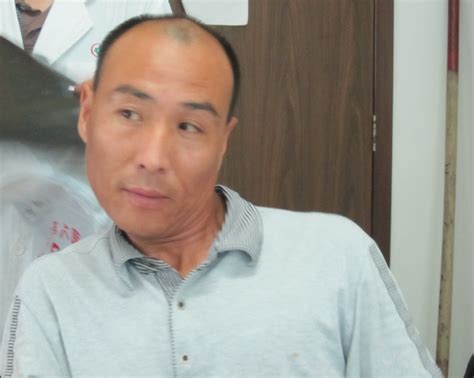 斜颈微创手术图片 斜颈后粘连的图片 斜颈后疤痕图片 第5页 大山谷图库