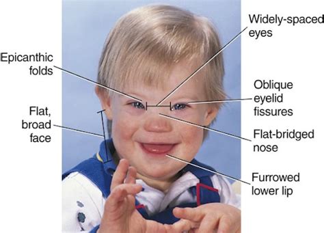Oral Embryology Oral Facial Anatomy Online