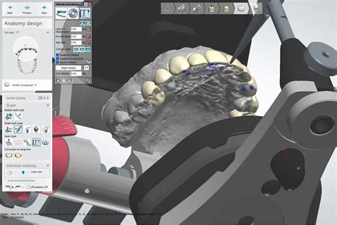 Лечение на Бруксизъм Virtue Dental Center