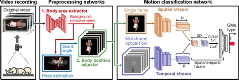 Automated Classification Of General Movements In Infants Using A Two Stream Spatiotemporal