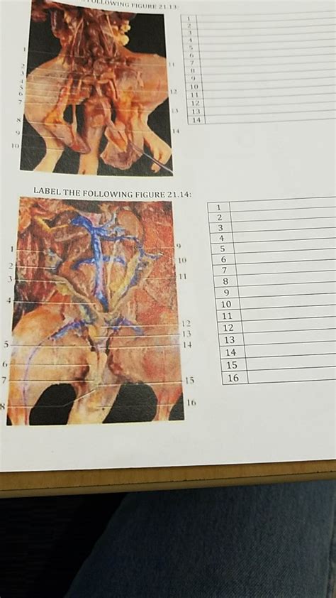 Lab 15 Pre Lab Exercise Rat Dissection A Photographic