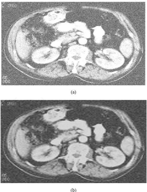 Introductory Chapter Signal And Image Denoising IntechOpen