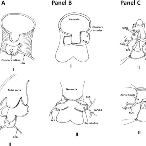 In Panel A Steps I And Ii Show A Technique Of Relocation Of A Single