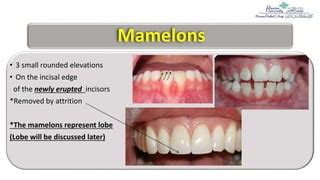 2 Anatomical Landmarks And Dental Tissuespptx