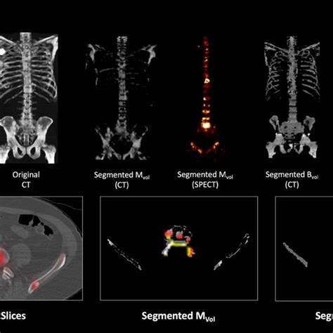 Examples Of The Segmentation Output Three Dimensional Maximum