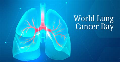 Raising Awareness On World Lung Cancer Day Accessnethealth
