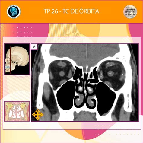 Equipo De Imágenes TomografÍa Computarizada De Órbita Imagen A