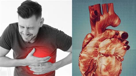 हार्ट ब्लॉकेज होने पर दिखते हैं ये लक्षण इन साइन के दिखते ही हो जाएं सतर्क Signs Of Heart