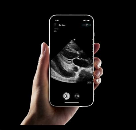 Mindray TE Air Wireless Ultrasound Transducer Probe Scanner UDS