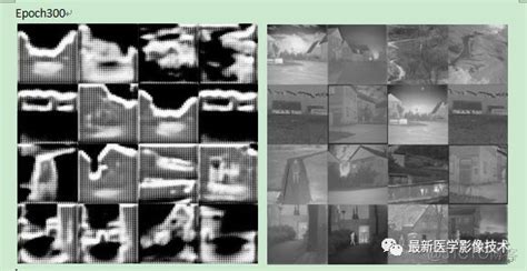图像融合生成对抗网络案例 51cto博客 生成对抗网络图像分割