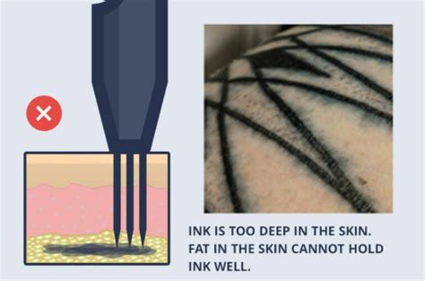 Tattoo Blowout Or Healing How To Tell If Your Tattoo Is Messed Up