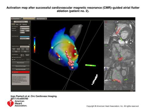 Circ Cardiovasc Imaging Ppt Download