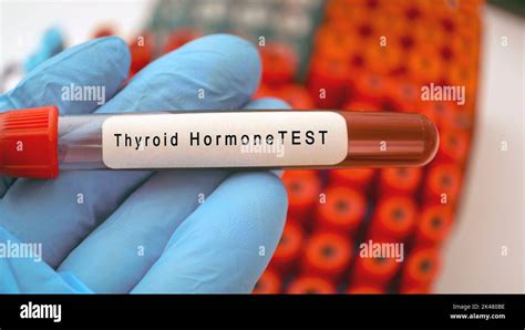 Thyroid Blood Test Conceptual Image Stock Photo Alamy