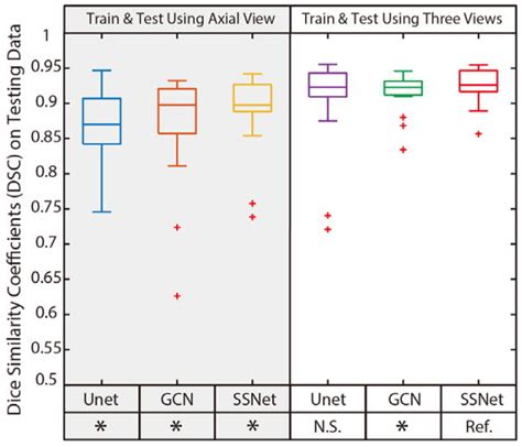 Splenomegaly Segmentation Using Global Convolutional Kernels And Conditional Generative