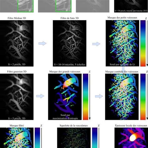 3 Effet De Lalgorithme « Rolling Ball Sur Lhistogramme Gauche Download Scientific
