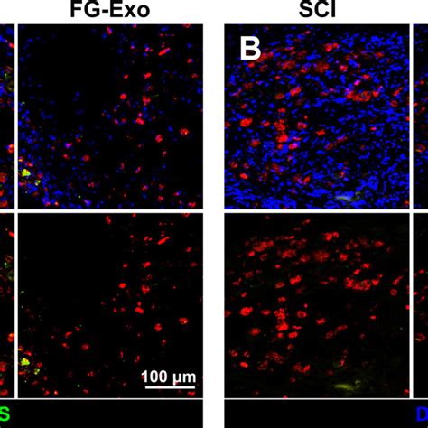 Immunofluorescence Staining Of Oxidative Damage Products 4 Hne And