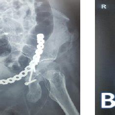 X Ray Post Operation Download Scientific Diagram