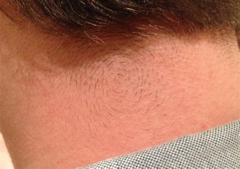 Why Did Graphic Content Sites Such As Bestgore Ogrish And