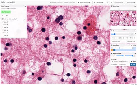 Histomicstk Manage Analyze And Visualize Your Digital Pathology Data