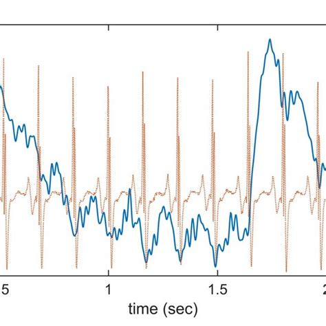 Fft Of Ecg And Ppg Signal Showing A Hr Of 625 Hz 375 Bpm The Ppg