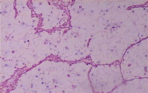 General Pathology Infection