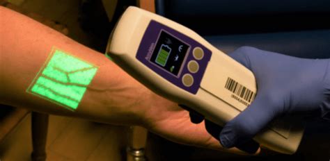 How Does A Vein Finder Work