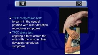 TFCC Triangular Fibro Cartilage Complex Injury PPT