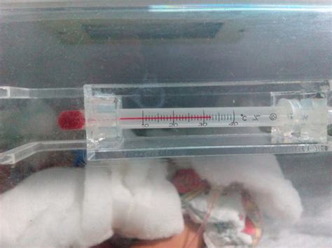 How To Measure Body Temperature Surgicaltechie Com