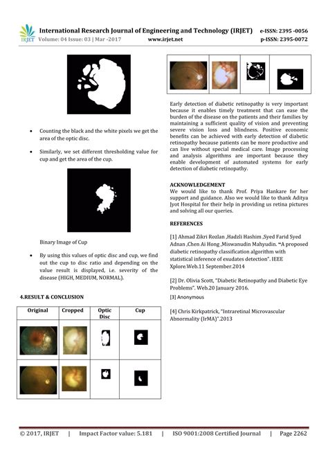 Optical Disc Detection Localization And Glaucoma Identification Of