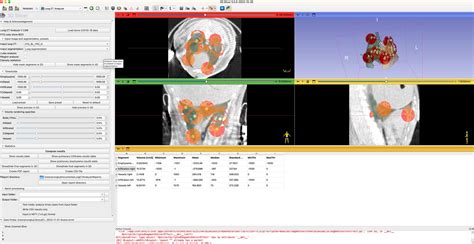 Inquiry Regarding Totalsegmentator V2 Compatibility With Rabbit Micro