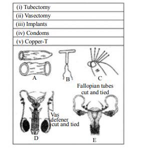 Match The Following Figures Given As A B C And E With Their Respective Names Given Below As