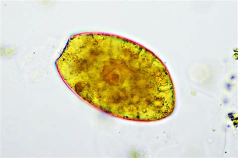 Premium Photo Understanding Preventing And Treating Trichinellosis Infections