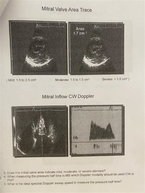 [solved] Mitral Valve Parasternal Long Axis Mitral Valve M