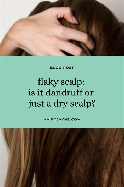 Flaky Scalp Problems Is It Dandruff Or A Dry Scalp Artofit