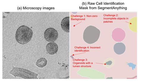 230904190 Segmentanything Helps Microscopy Images Based Automatic And Quantitative Organoid