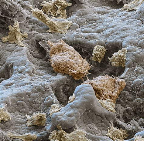 Shed Milk Tooth Sem Stock Image C057 8524 Science Photo Library