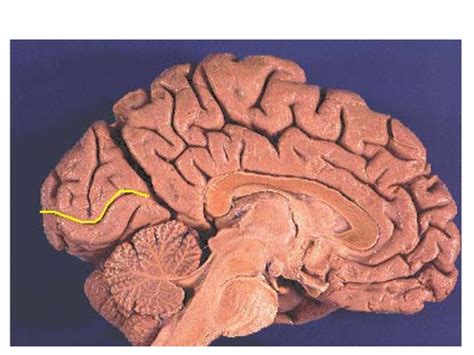 Striatevisual Cortex Part 1 Part 3 Vsp Flashcards Quizlet