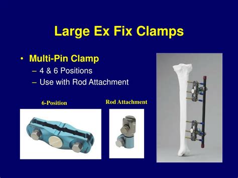 Ppt Implants And Instruments For Large External Fixation Powerpoint