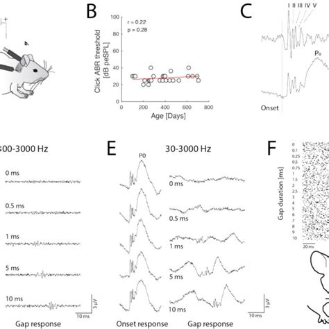 Auditory Brainstem Responses And Ic Multiunit Recordings In Young And Download Scientific
