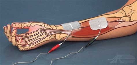 Finger Flexion