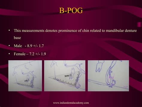 COGS Analysis Cephelometrics For Orthognathic Surgery Fixed Orthodontics Courses India PPT
