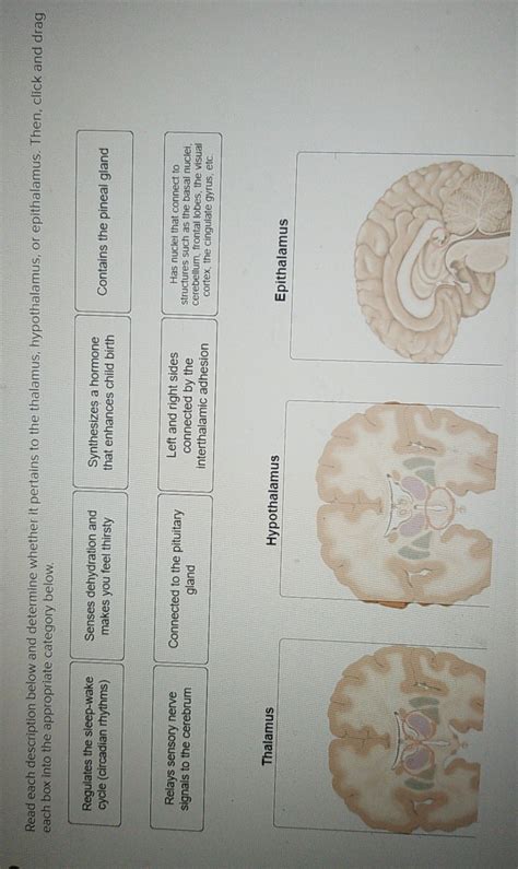 Solved Post Lab Brain And Cranial Nerves Read Each Description