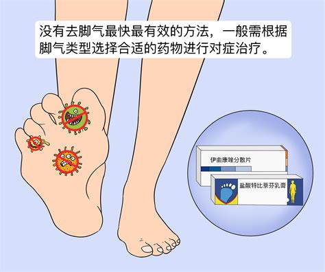 怎么去脚气最快最有效 有来医生