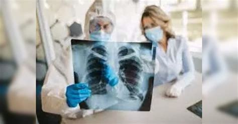 Research Shows How Ai Identifies Normal Abnormal Chest X Raysethealthworld