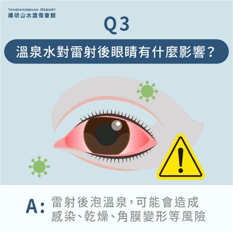 眼睛雷射可以泡湯嗎 3個常見QA帶你看陽明山水溫泉會館100 天然白磺溫泉